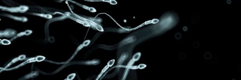 Hyperspermia: Symptoms, causes, Diagnosis & treatment