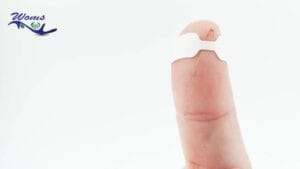 Butterfly Bandage: What is it and how it used? - WOMS