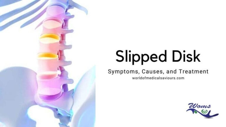 Slipped Disk | Symptoms, Causes, and Treatment - WOMS