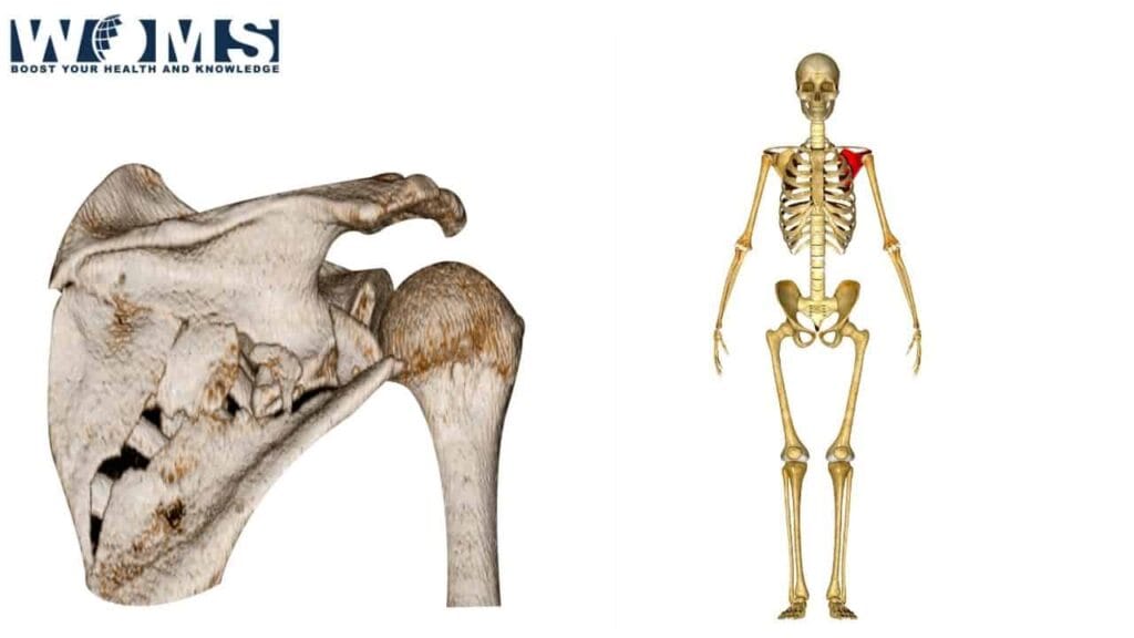 Ligament of Treitz: An In-Depth Look at Its Anatomical Significance - WOMS