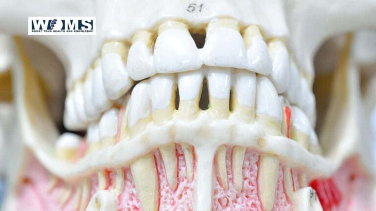 Are Teeth Bones? | Exploring the Facts about teeth - WOMS