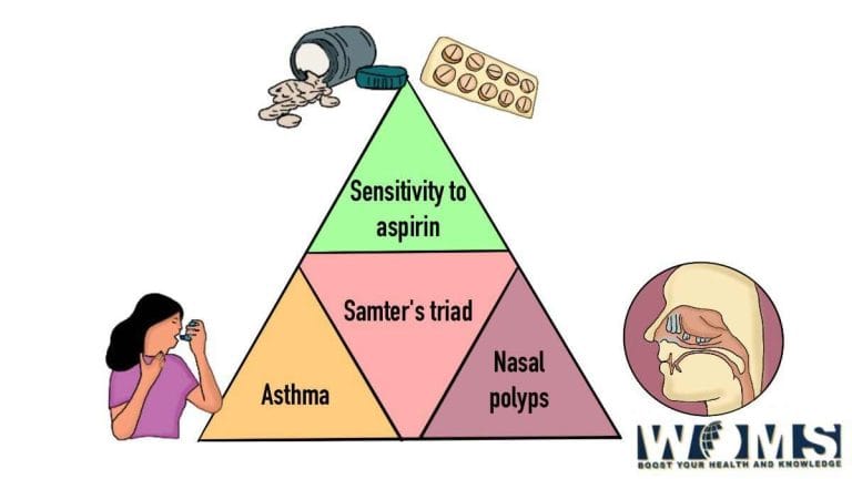Samter’s triad: pathophysiology, symptoms & Treatment - WOMS