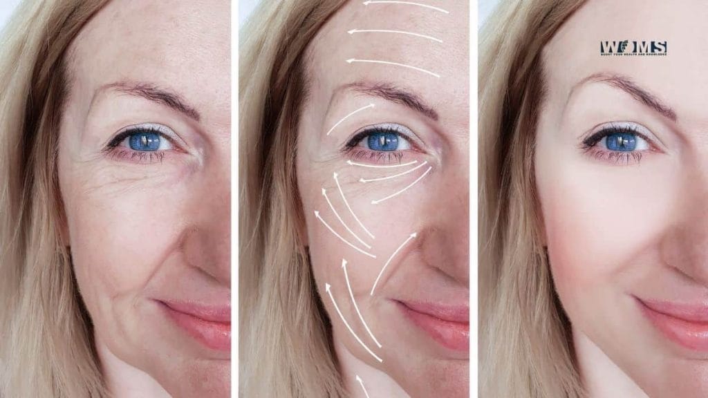 What You Should Know About Profound RF? - WOMS