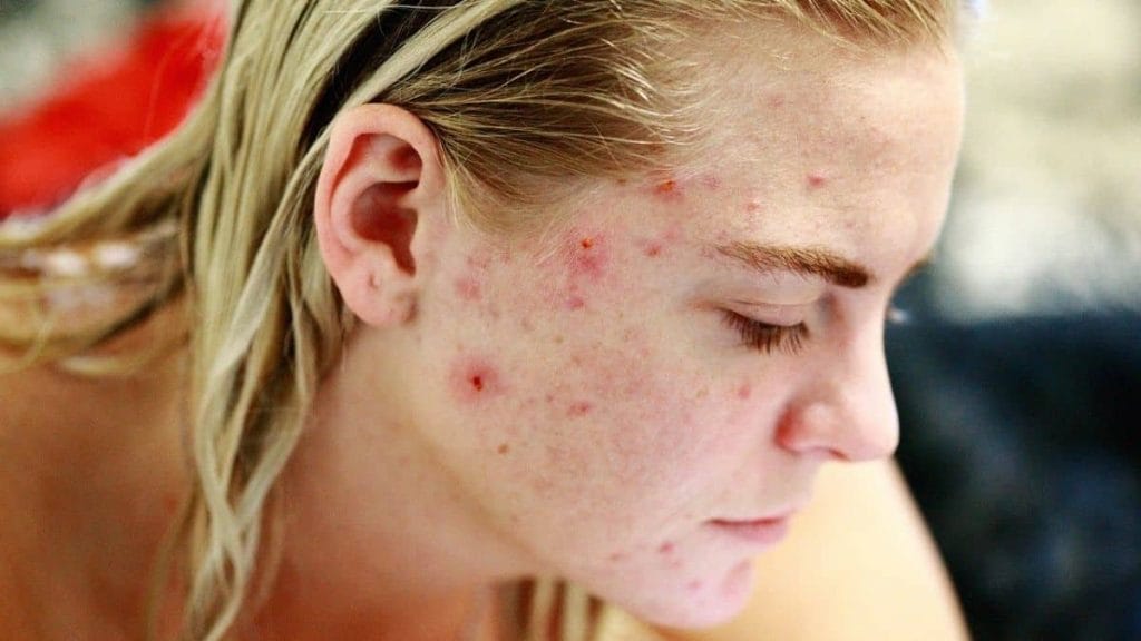 Rare Skin Diseases that People find hard to talk about - WOMS
