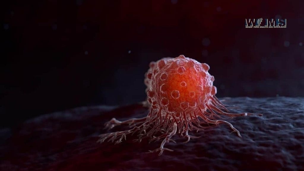 Top 7 Cancer Causes You Should Know About - WOMS