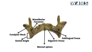 Movable Bone in the Skull - WOMS