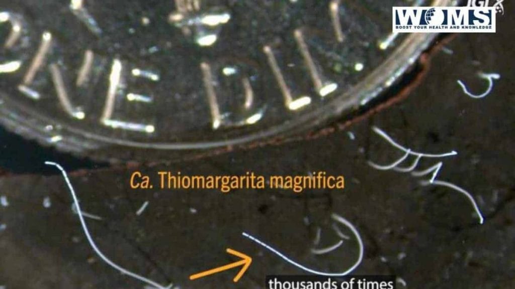 World's largest bacteria - WOMS