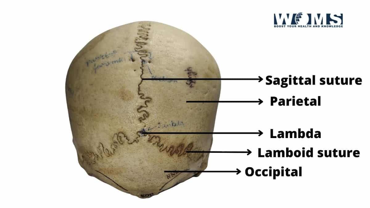 8 Cranial bones: Anatomy, & Clinical Conditions - WOMS