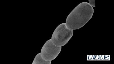 World's largest bacteria - WOMS