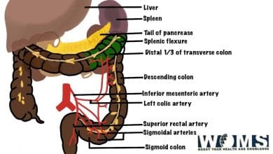 Sigmoid Colon: 7 important clinical conditions - WOMS
