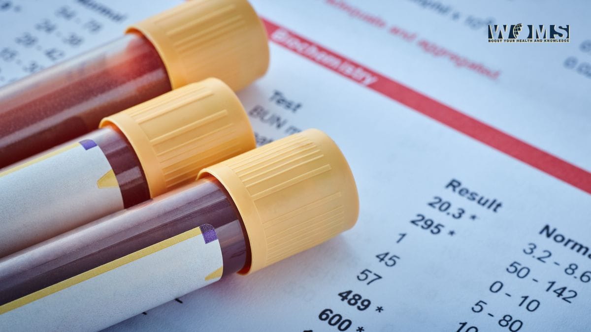 Top 5 Important Blood Tests For People Above 30 WOMS