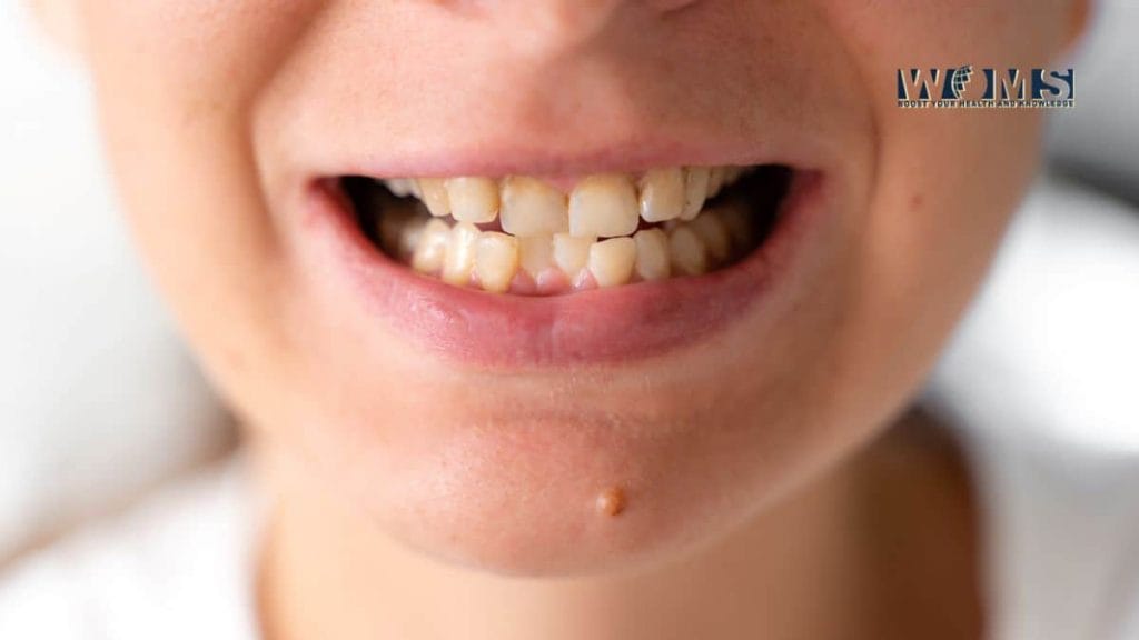 8 Tips That Might Help Your Crooked Teeth - WOMS