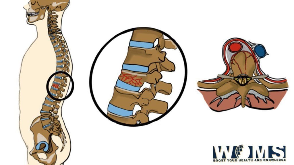 Cranial Fossa: Contents, Anatomy and Clinical Significance - WOMS