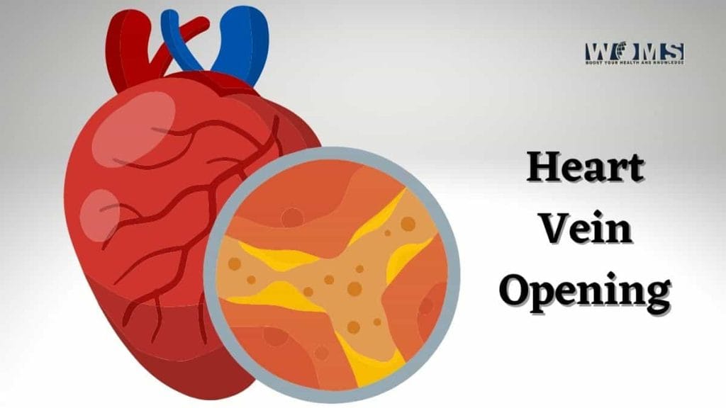 Cardiac Muscle Diagram, Anatomy and Clinical Significance - WOMS