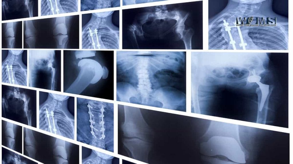 Everything You Need to Know About Digital X-Rays - WOMS