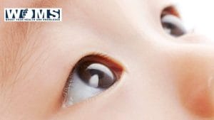 A Comprehensive Guide to Narrow Angle Eyes - WOMS