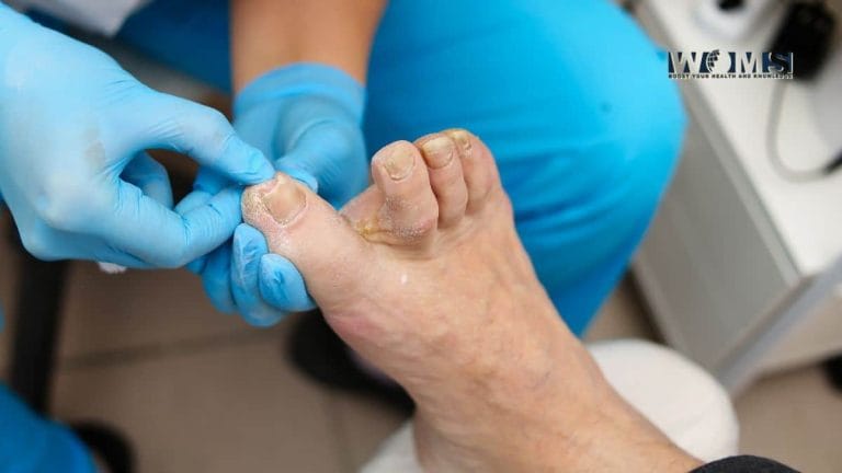 How to Know if Toenail Fungus is Dying: A Comprehensive Guide - WOMS